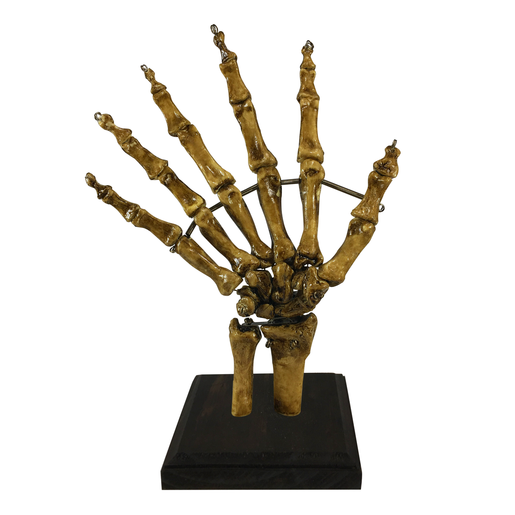 Bizarre! Vintage 6 Finger Skeleton Hand – asylumzone