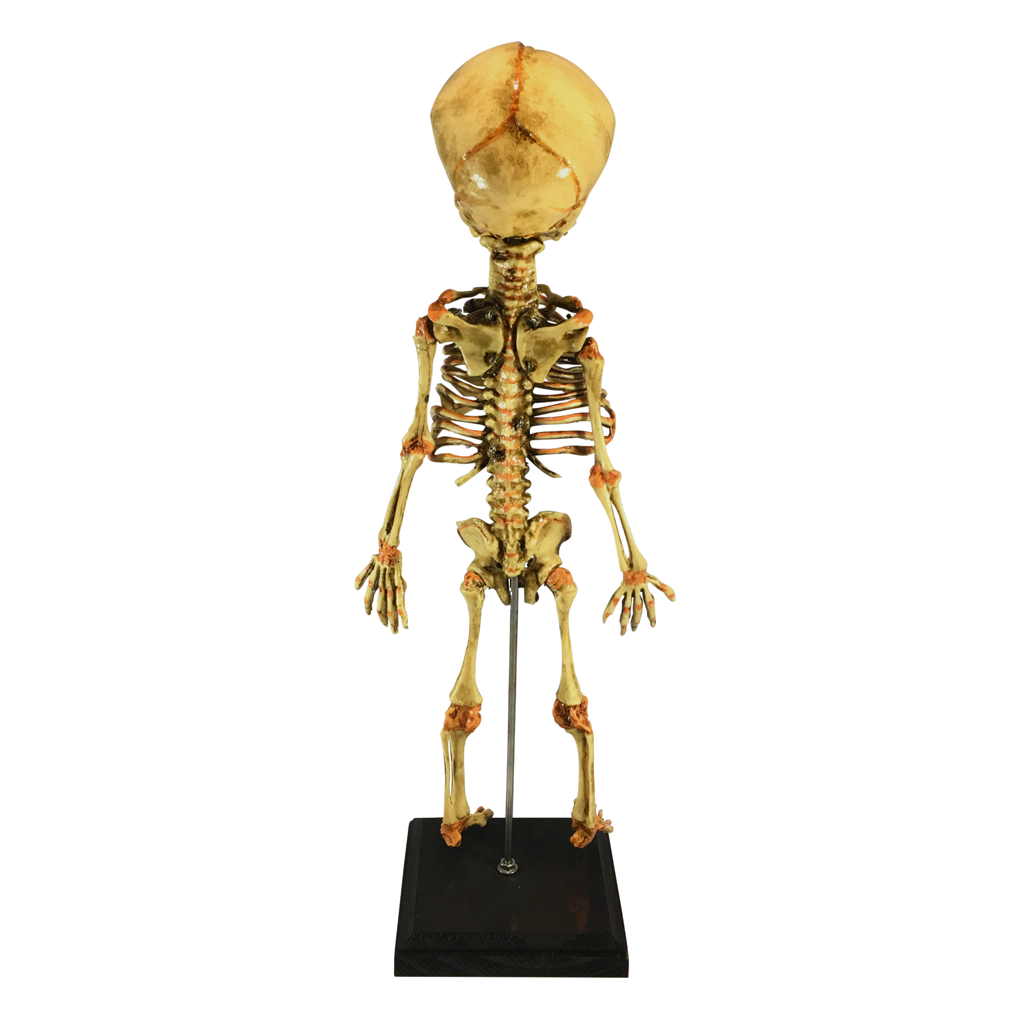 Vintage Baby Fetus Skeleton – asylumzone